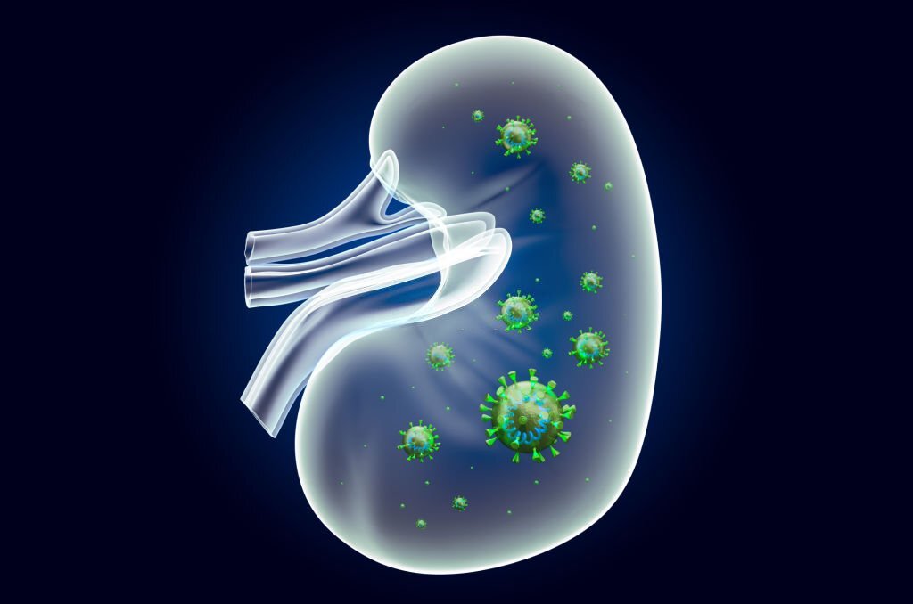 "Unraveling the Mystery: What Causes Kidney Stones and How to Protect ...